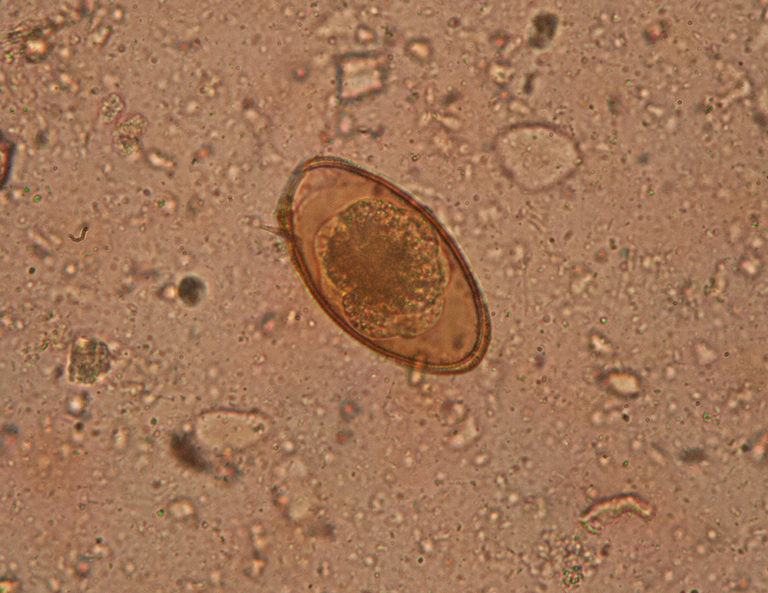 Parasites – Madcham.de
