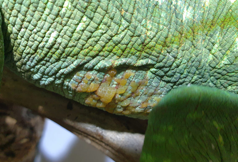 Mykosen – Madcham.de